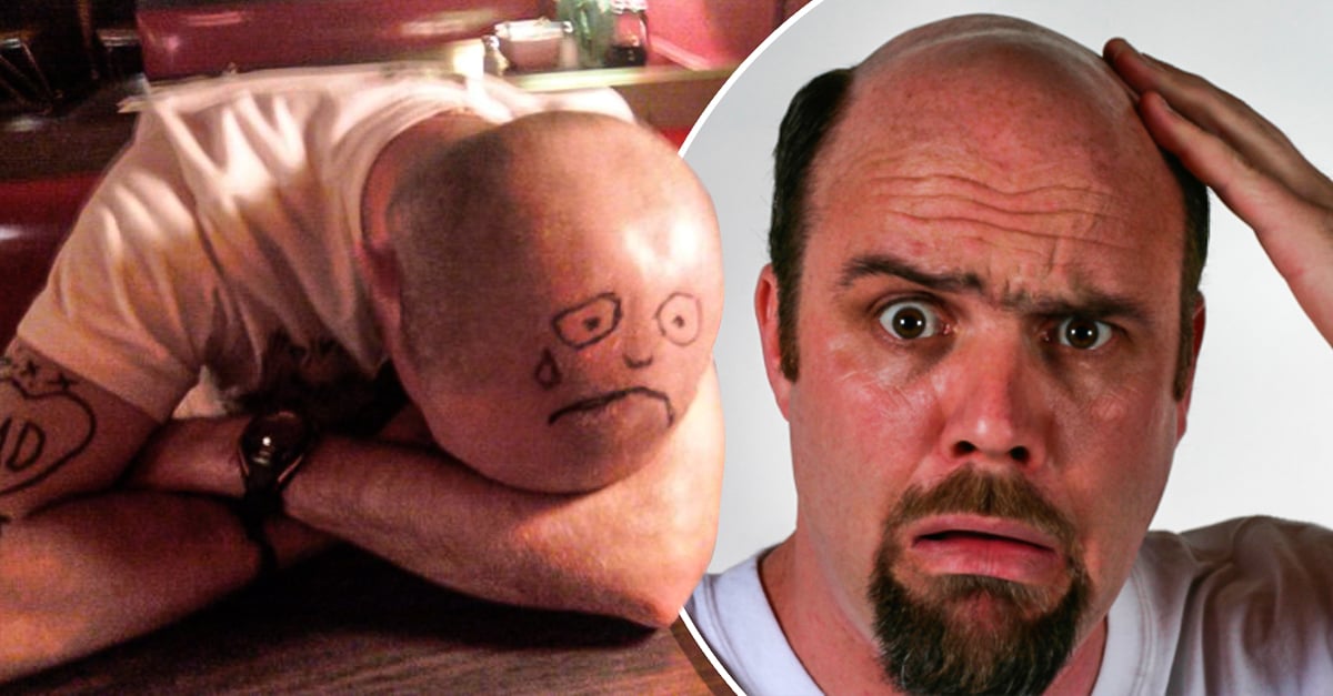 El ser calvo puede tener un impacto severo en la salud mental