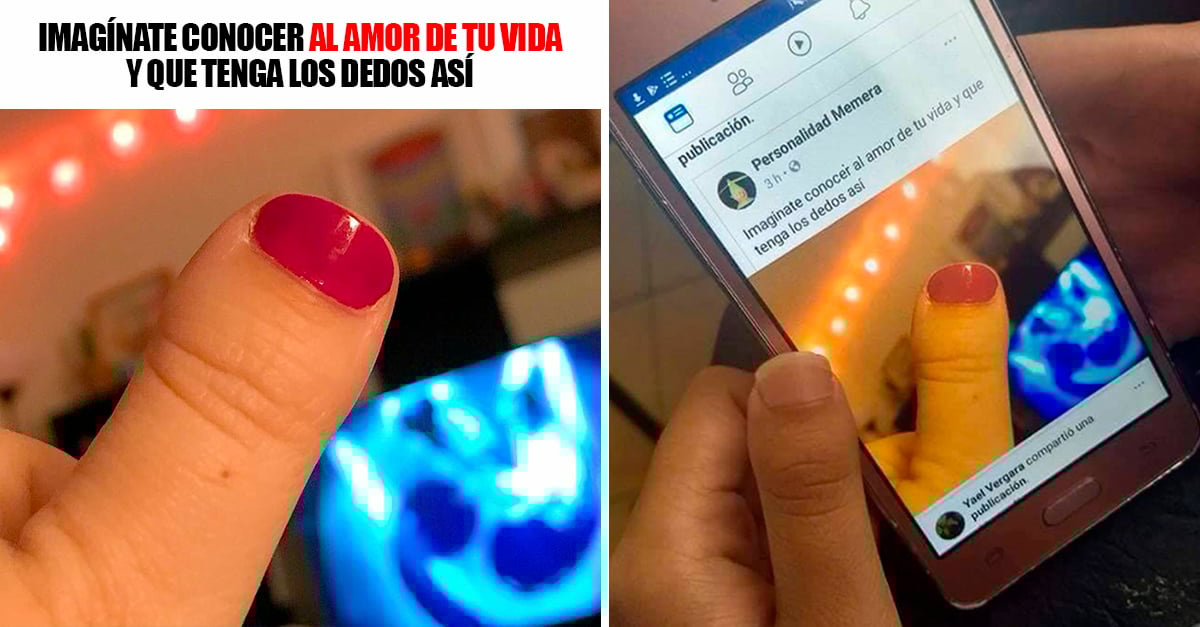 La Comunidad Del Dedo Chato Se Une Gracias A Un Meme la-comunidad-del-dedo-chato-se-une-gracias-a-un-meme