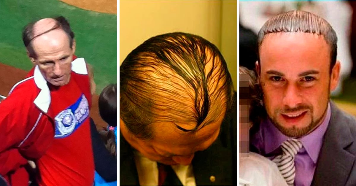 Bizarra razón por la que los calvos no deben visitar Mozambique