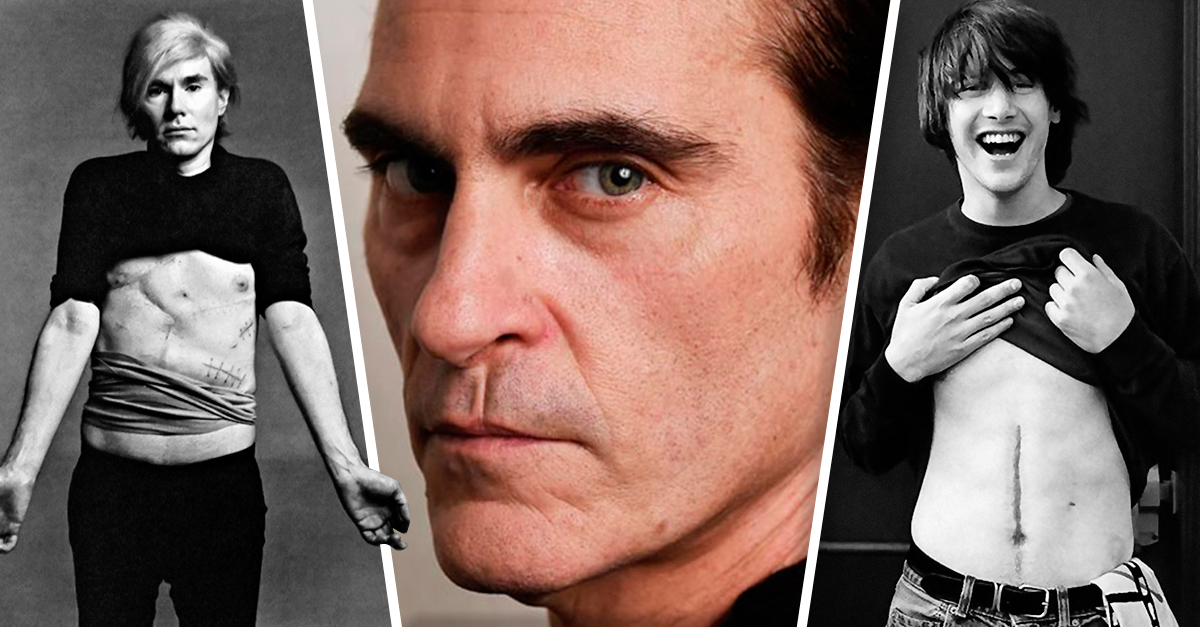 15 Celebridades con interesantes cicatrices y su historia