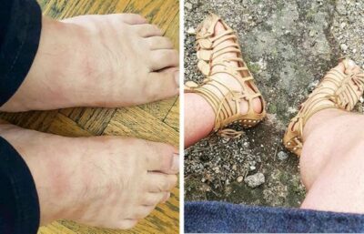 25 Personas “quemadas” que arruinaron su bronceado