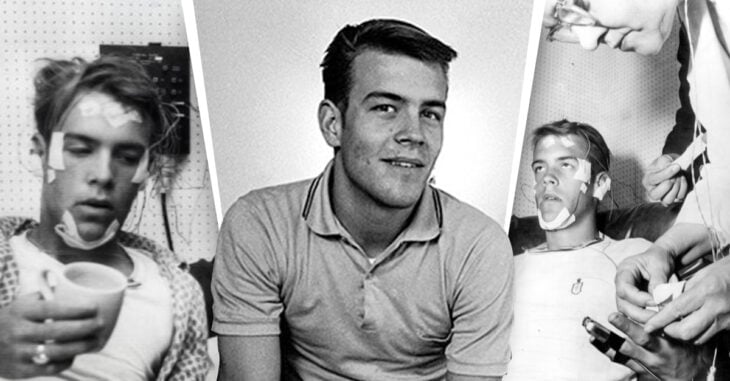 Albert Stevens, el hombre más radioactivo de la historia