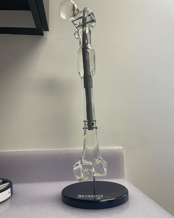 Doctor promete hacerte más alto con una compleja cirugía