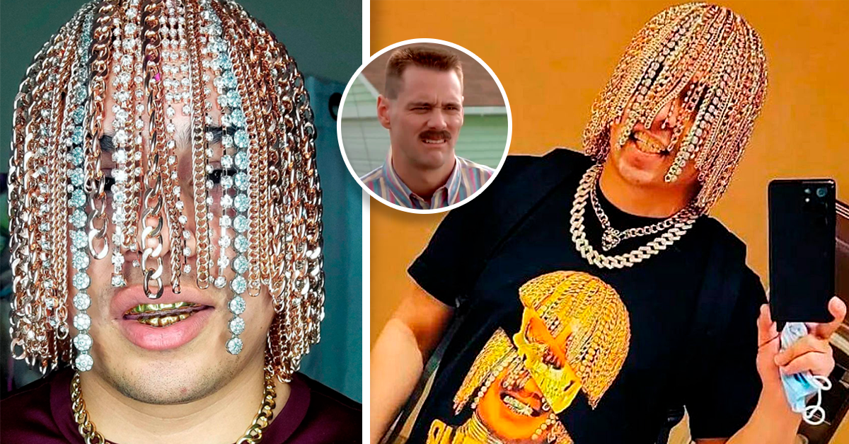 Dan Sur se implantó cadenas en la cabeza para tener pelo dorado