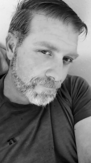 Trabajador de ‘Rust’ casi pierde un brazo por mordedura de araña