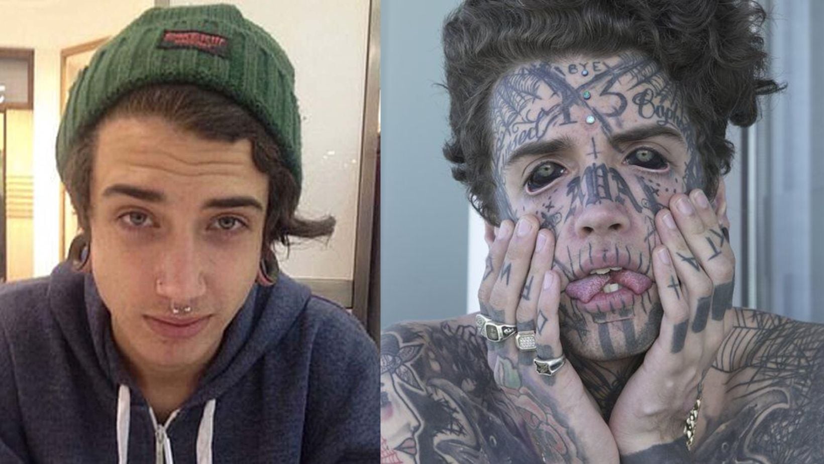 Hombre que se tatuó toda la cara ahora se arrepiente